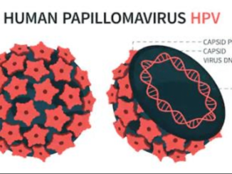 diagnosis of Human Papilloma Virus (HPV) Archives - Public Health Notes