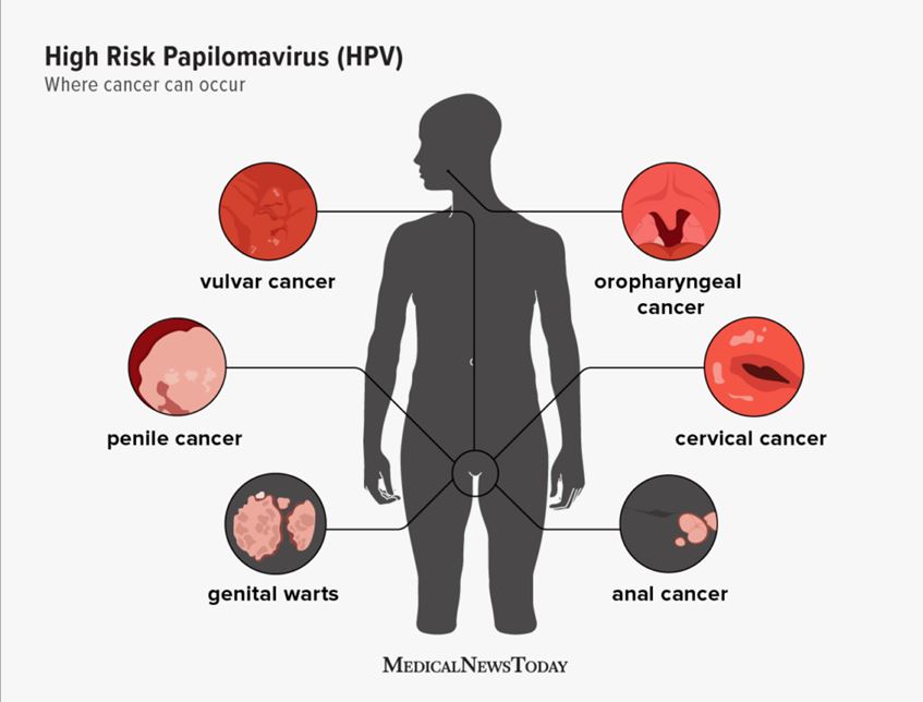 where cancer can occur - Public Health Notes