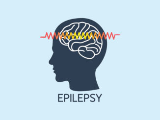 key facts about epilepsy Archives - Public Health Notes