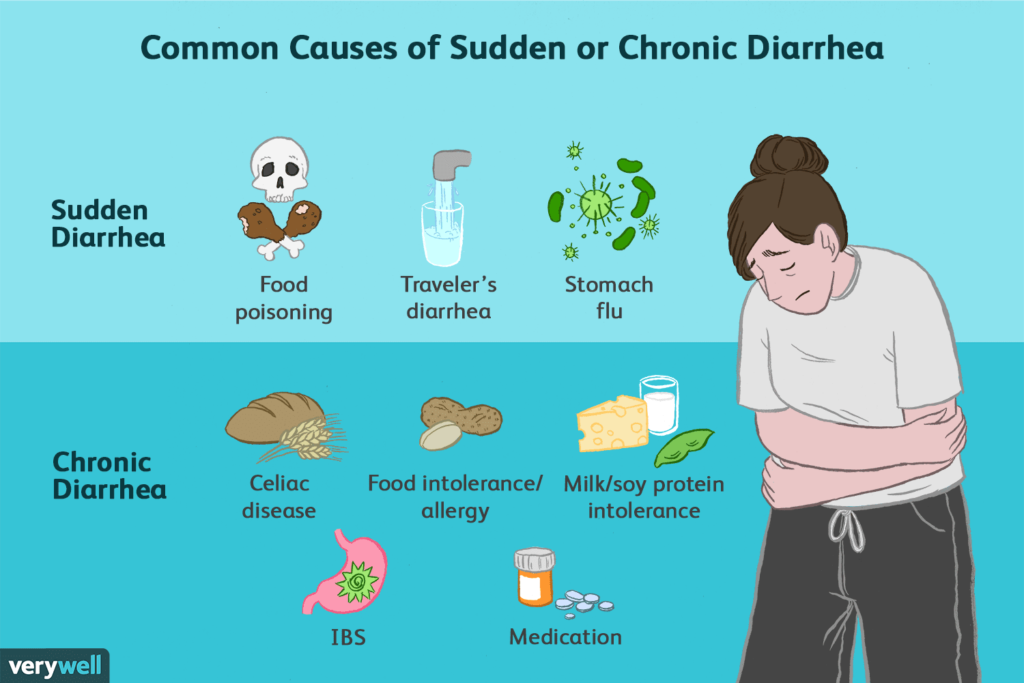 Diarrhea: Causes, Symptoms & Treatment - Public Health Notes